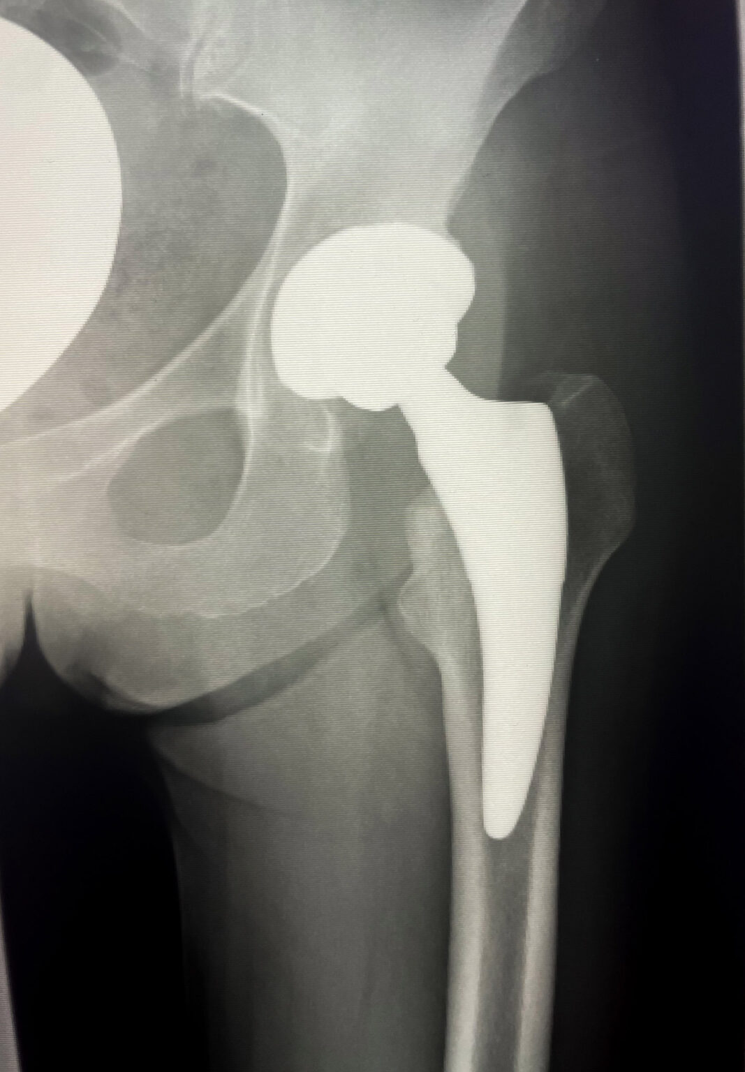 Physiotherapie spielt eine entscheidende Rolle bei der Rehabilitation ...