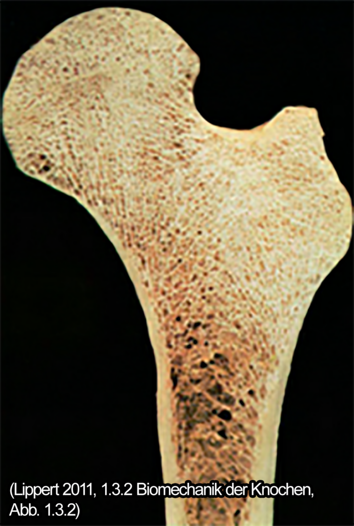 Was ist Osteoporose? - Ein Überblick | PraxisMalz